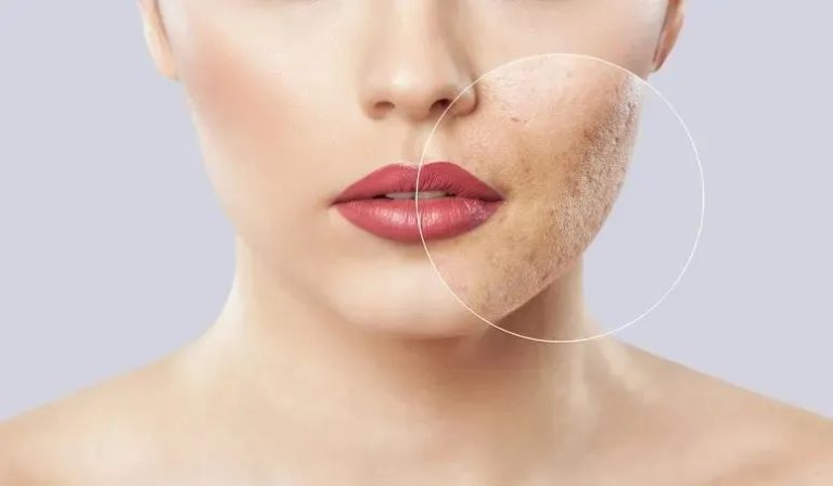 Reduce Pore Size for Smoother, Clearer Skin | Health Olistics